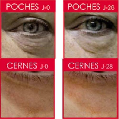 LUMINEYE Lumin'Eye Corrective Care for Pockets and Dark Circles Und...